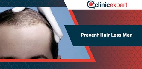 Prevent Hair Loss Men Clinicexpert Healthcare
