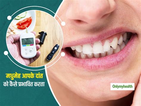Learn How Diabetes Affects Your Teeth And What Is The Method Of