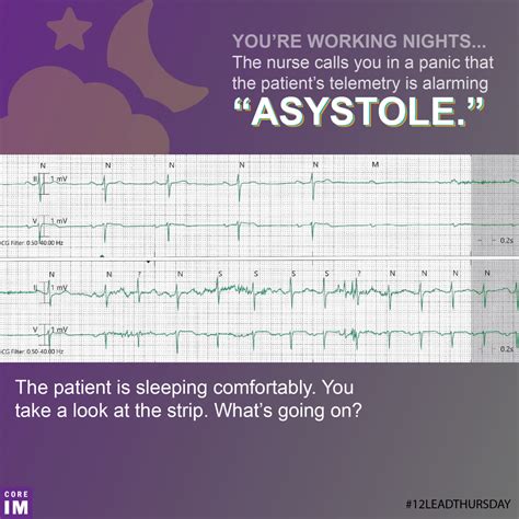 tele alarm asystole core im podcast