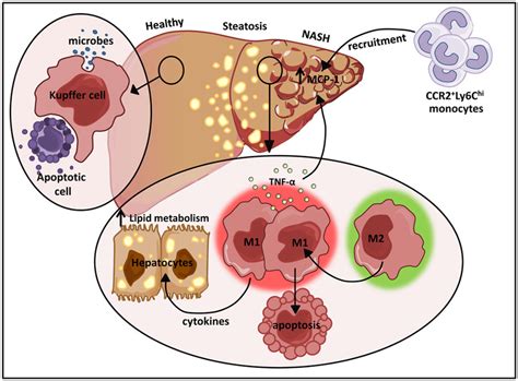 The Dual Role Of M1 M2 Kupffer Cells In Nafld Kupffer Cells Play A
