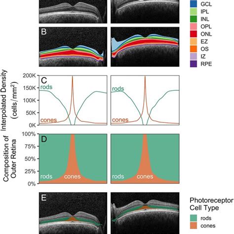 The Reference Model Relates Onl Thickness To Expected Proportions Of
