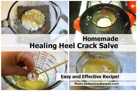 Homemade Healing Heel Crack Salve