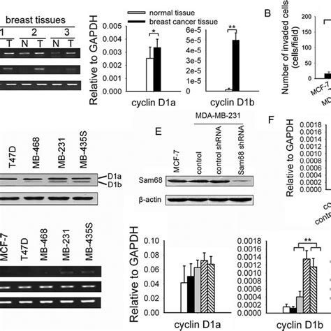 Cyclin D1b Splice Variant Characterizes The Metastatic Phenotype Of
