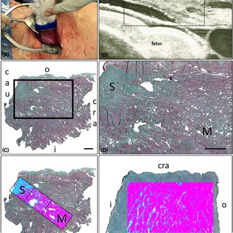 Intraoperative Ultrasound And Histological Staining Of The Sampled