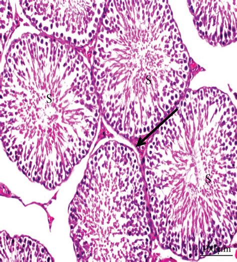 Photomicrographs Of Sections In Testis Of Control Rat Groups A