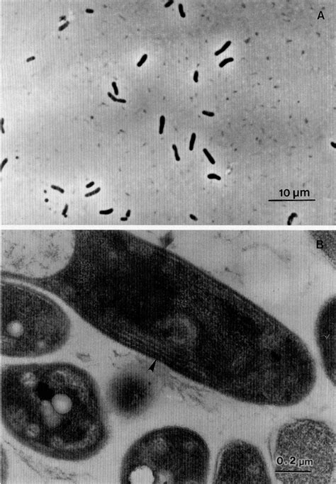Phase Contrast Photomicrograph Of Intact Cells A And Transmission