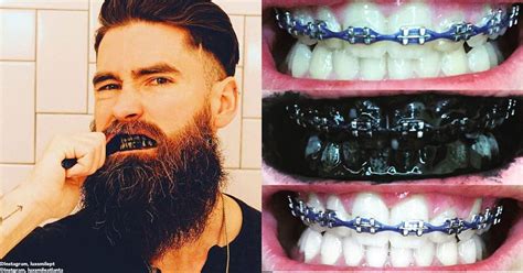 here s why you should stop using that charcoal toothpaste today