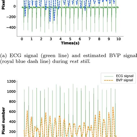 An Example Of Synchronized Ecg And Estimated Bvp Signal From 10 Seconds