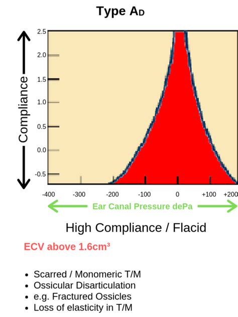 Tympanometry ¦ Middle Ear Test ¦ Hearing Test ¦ Audio Tests