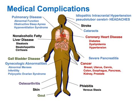 Bariatric Surgery Morbid Obesity Overview Dr Anastasios