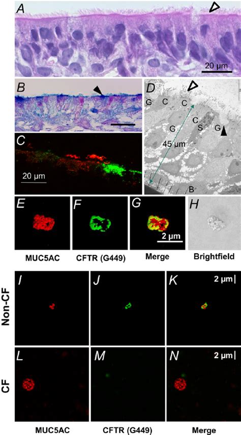 Cftr Expression In Mucin Granules From Highly Differentiated Airway