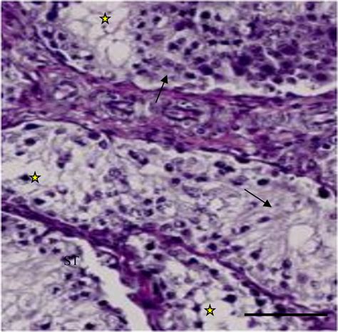 Light Micrograph Of Section In The Testicular Tissues Of Tio2