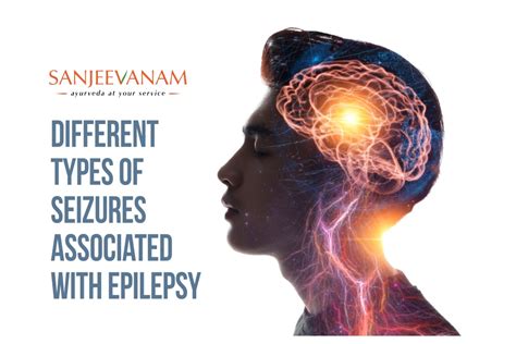 Ppt Different Types Of Seizures Associated With Epilepsy Powerpoint