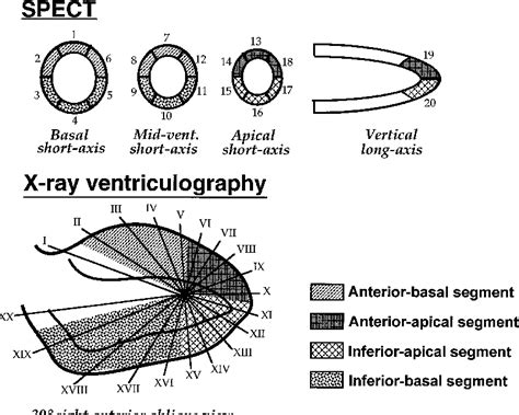 Figure 1 From Assessment Of Myocardial Viability In Patients With