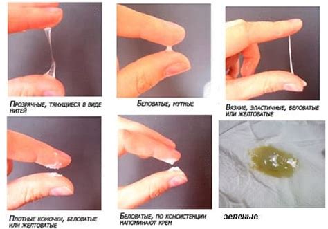 Выделения при беременности на ранних сроках какие должны быть норма