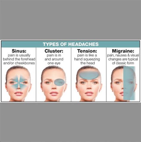 Headache Chart Types By Symptoms Location And Causes