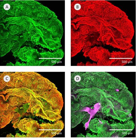 Stemdiff™ Choroid Plexus Organoid Differentiation Kit Stemcell
