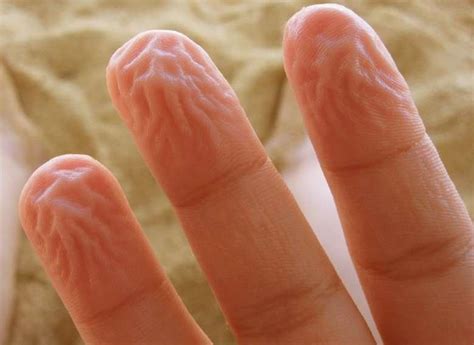 Dry Fingertips Fingernails At Rachell Anderson Blog