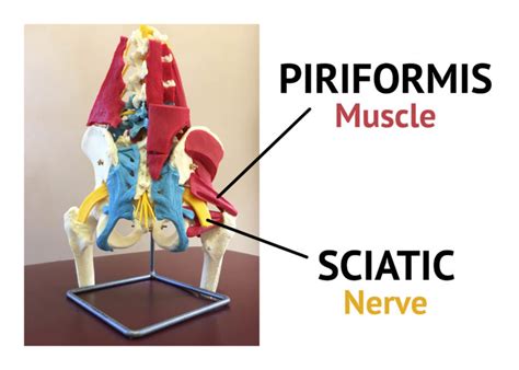 Piriformis Syndrome Cioffredi And Associates