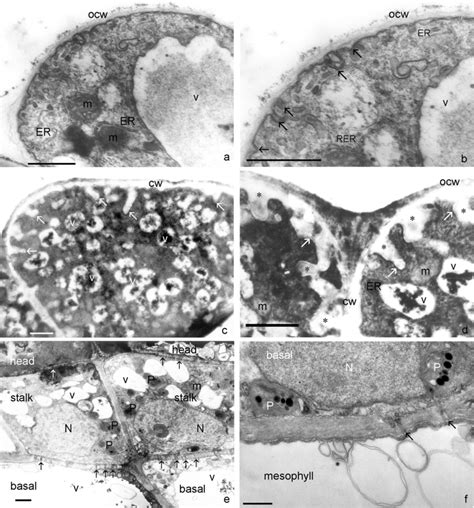 Ultrastructure Of Trichome Glandular Secretory Cells In R Acetosella