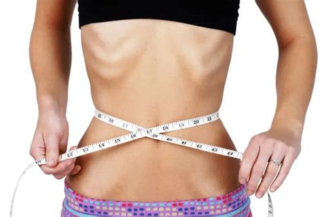 Anorexia Nervosa Symptoms Causes Diagnosis And Treatment Credihealth
