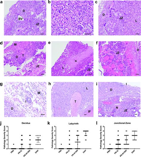 Hematoxylin And Eosin Hande Staining Of The Placental Tma A C E Hande