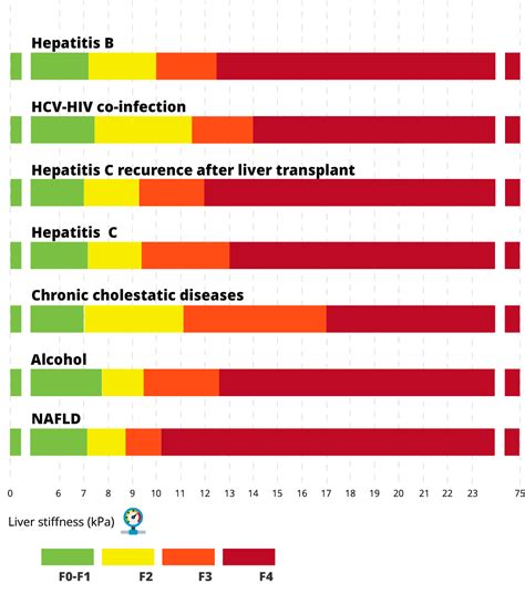 Fibroscan Chart Levels