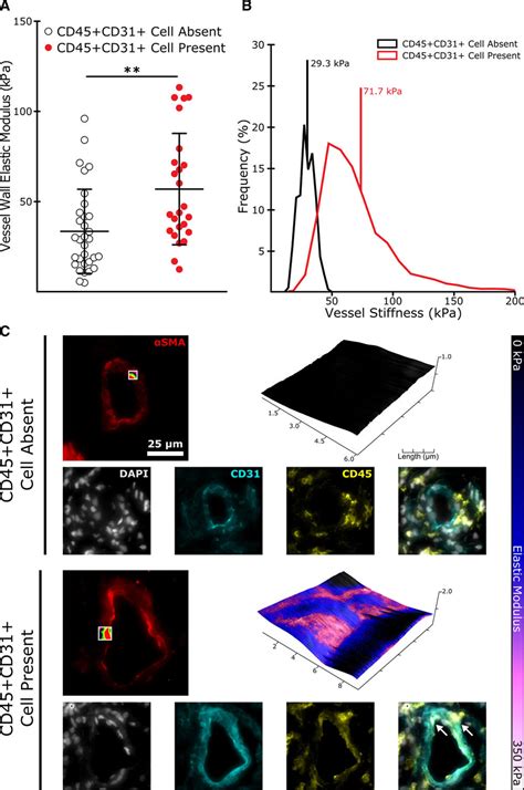 Bone Marrow Derived Proangiogenic Cells Mediate Pulmonary Arteriole