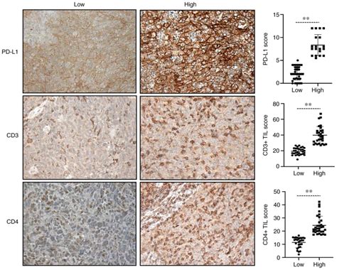 Expression Of Pd‑l1 And Cd4 Tumor‑infiltrating Lymphocytes Predict