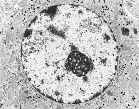 Liver Cell Nucleus 1 By Dennis Kunkel Microscopy Science Photo Library
