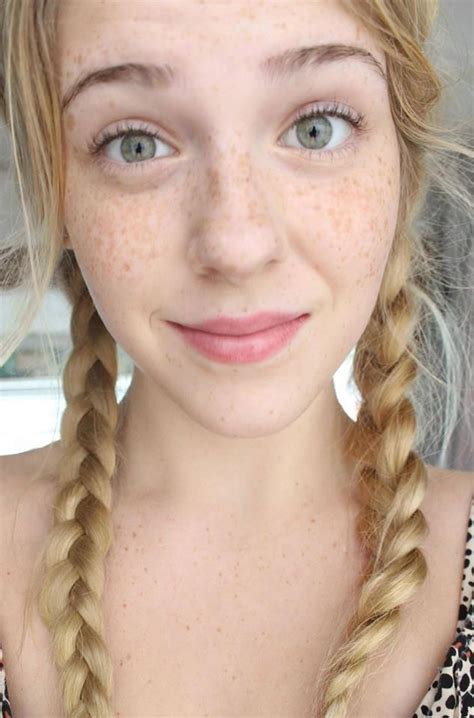Pin By Patrick Pakié On Taches De Rousseur Beautiful Freckles