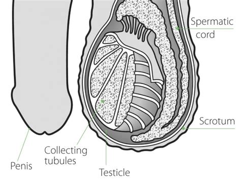 testicular cancer irish cancer society