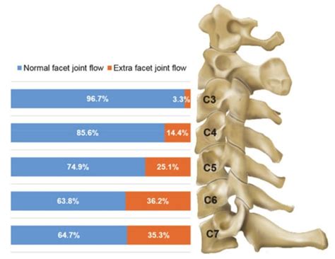 Jcm Free Full Text Fluoroscopic Findings Of Extra Cervical Facet