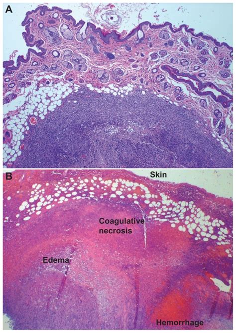 A Hematoxylin And Eosin Stained Tumor Section Of A Representative