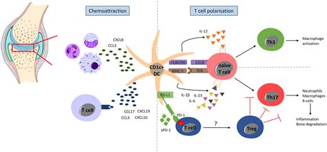 Dendritic Cells T Cells And Their Interaction In Rheumatoid Arthritis