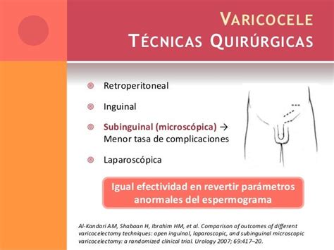 Varicocele