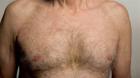 6 things men affected by breast cancer want you to know huffpost uk life