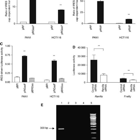 Reverse Transcriptase Pcr To Investigate Expression Of The Two Gastrin