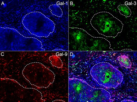 Immunofluorescent Staining Of Galectin 1 3 And 9 Representative