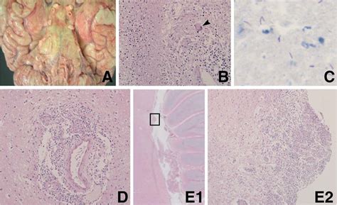 Pathological Findings Of The Autopsy Specimen A Macroscopic View