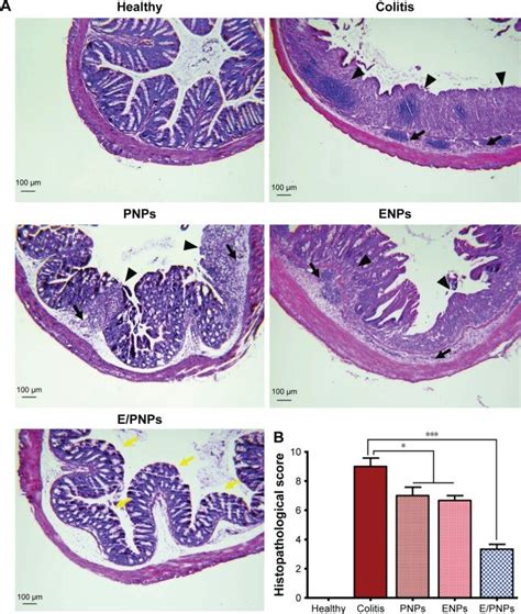 Histological Evaluation Of Colon Tissue A Hande Staining For