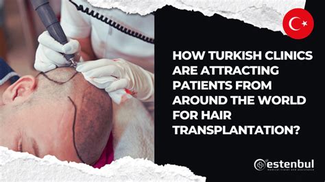 How Turkish Clinics Are Attracting Patients From Around The World For