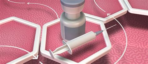 Contraception Which Option For Which Patient Bpac Nz