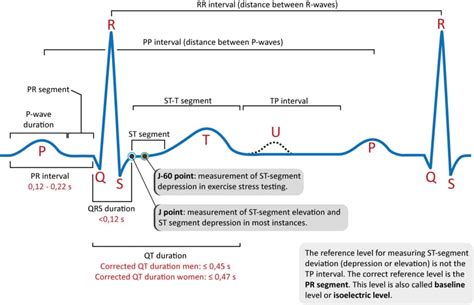 Ecg Interpretation Characteristics Of The Normal Ecg P Wave Qrs