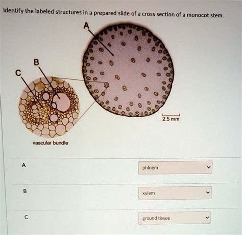 Solved Identify The Labeled Structures In A Prepared Slide Of A Cross