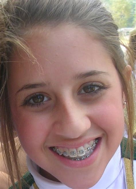 Young Girls With Braces Porn Videos Newest Xxx Fpornvideos
