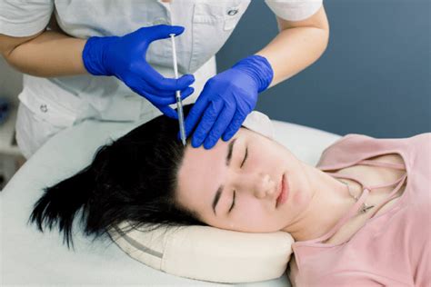 Woman Hair Transplant In Turkey Guide Curebooking
