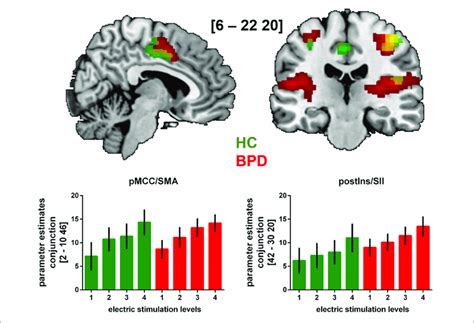 Fmri Results From Whole Brain Analysis Of Neural Activation During