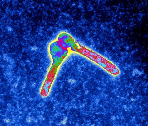 Advances Suggest Possible Cures For Ebola And Marburg Virus The New