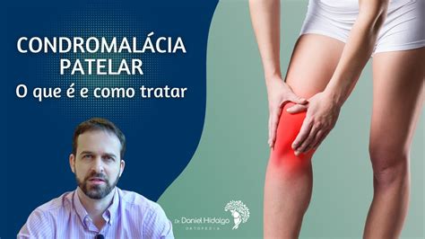 Condromalácia Patelar O Que é E Como Tratar Youtube